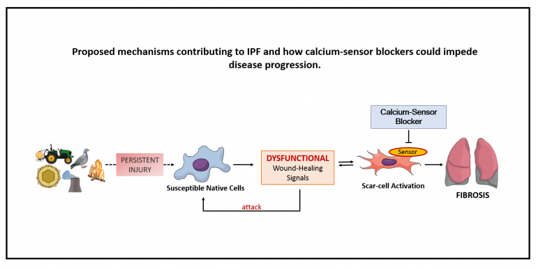 Idiopathic Pulmonary Fibrosis: my journey to finding a a new treatment ...